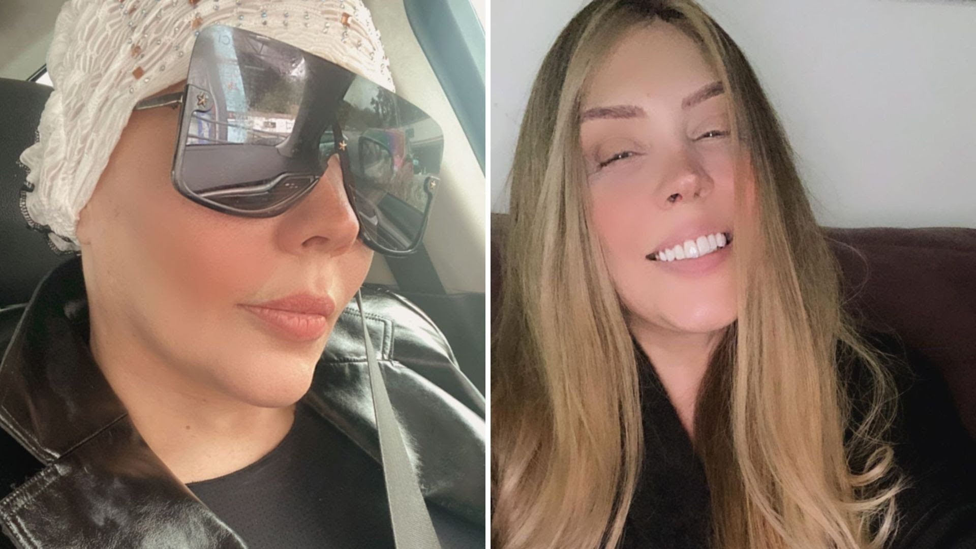 Simony lamenta queda de cabelo por tratamento de câncer: ‘difícil' Simony lamenta queda de cabelo por tratamento de câncer: ‘difícil'